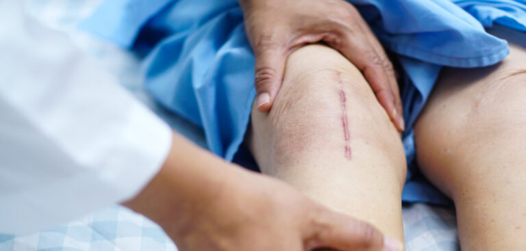 Fysiotherapie Roermond - Fysio Physics